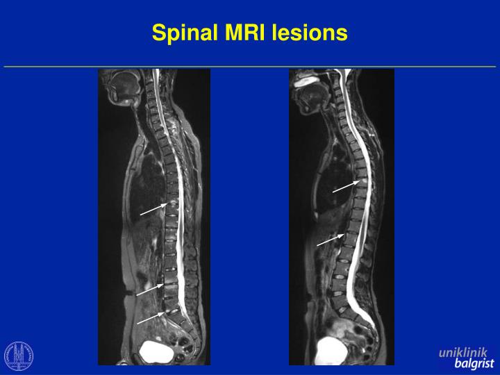 PPT - Role of MRI in Assessment and Diagnosis of Axial ...