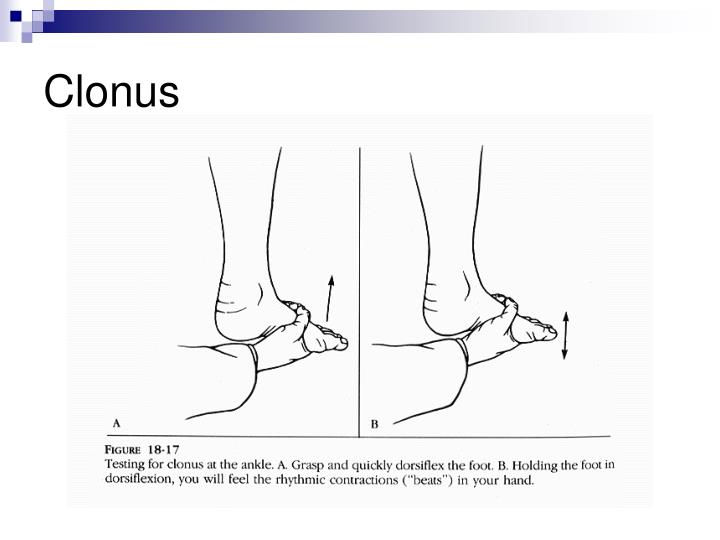 PPT - Pyramidal and Extrapyramidal disorders PowerPoint Presentation ...