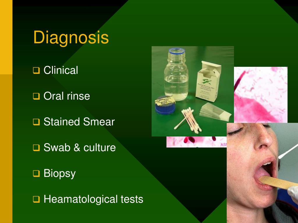 PPT - Fungal Infection Candidadiasis (Candidosis) PowerPoint ...