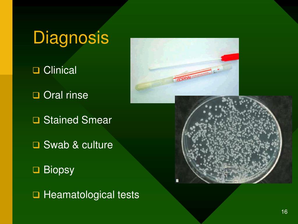 PPT - Fungal Infection Candidadiasis (Candidosis) PowerPoint Presentation - ID:3035567