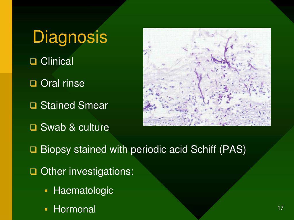 PPT - Fungal Infection Candidadiasis (Candidosis) PowerPoint Presentation - ID:3035567