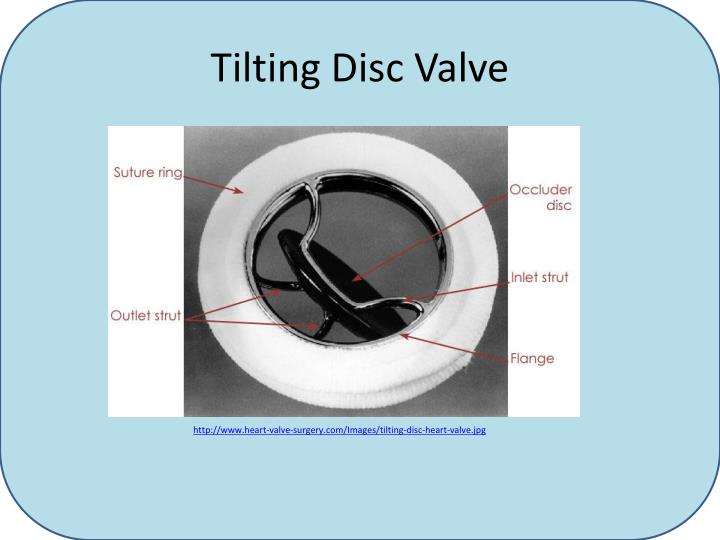 PPT - Heart Valves for Congenital Heart Disease Patients PowerPoint ...