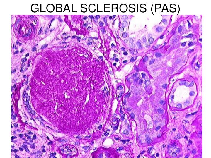 PPT - 1. Count all glomeruli, determine the number of sclerotic ...