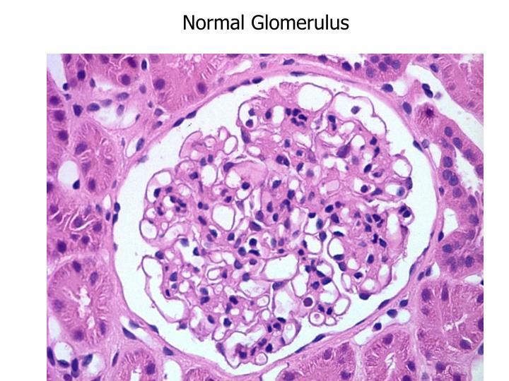 PPT - 1. Count all glomeruli, determine the number of sclerotic ...