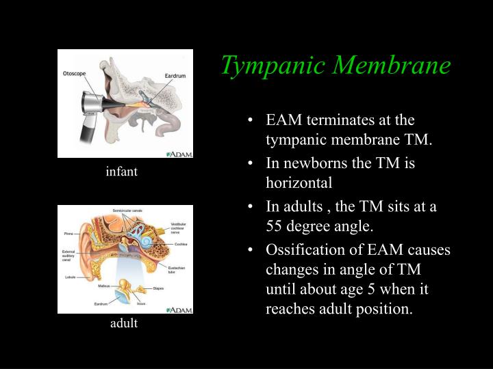 PPT - Tympanic Membrane PowerPoint Presentation - ID:3038672