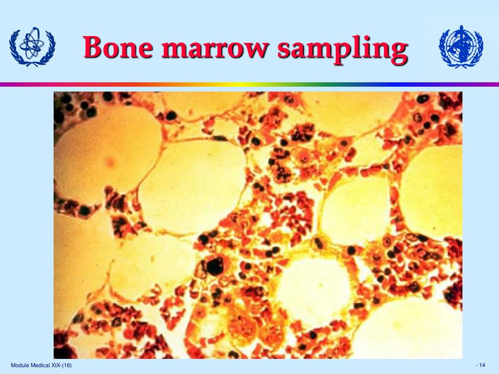 PPT - MEDICAL ASPECTS OF RADIOLOGICAL ACCIDENT IN GILAN, IRAN ...