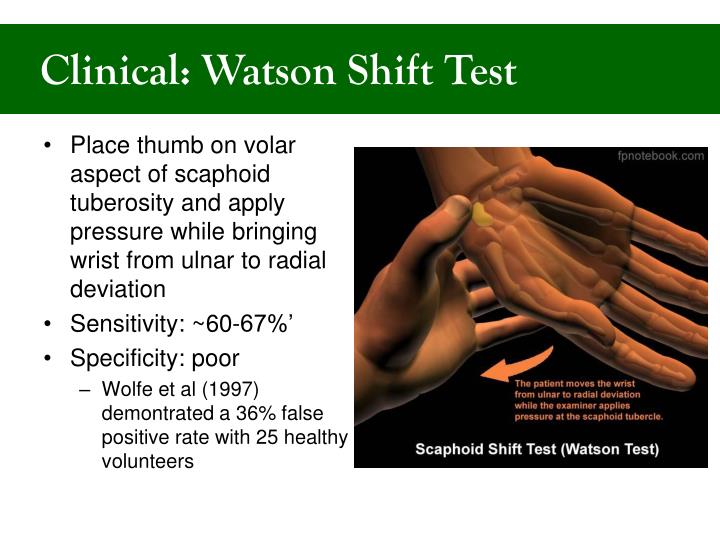 PPT - Xray Rounds: Carpal Instabilities Heather Patterson PGY 2 ...