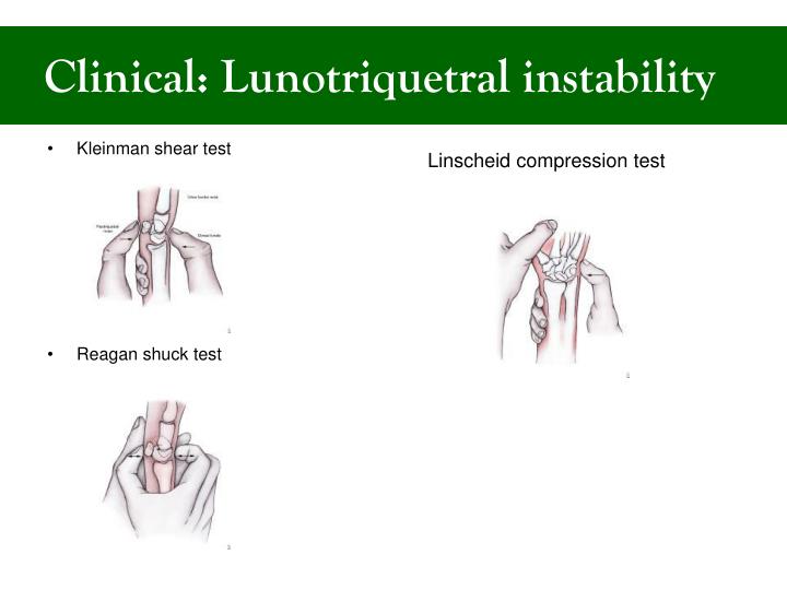 PPT - Xray Rounds: Carpal Instabilities Heather Patterson PGY 2 ...