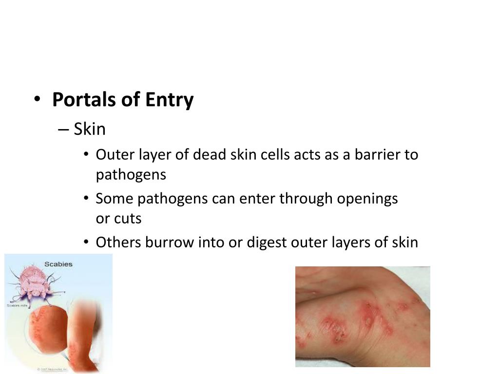 PPT - Disease, Disease Transmission, and Epidemiology PowerPoint ...