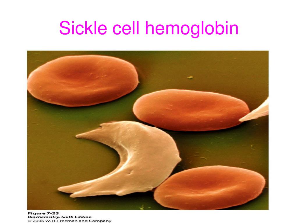 PPT - Hemoglobin metabolism & diseases of hemoglobin PowerPoint ...