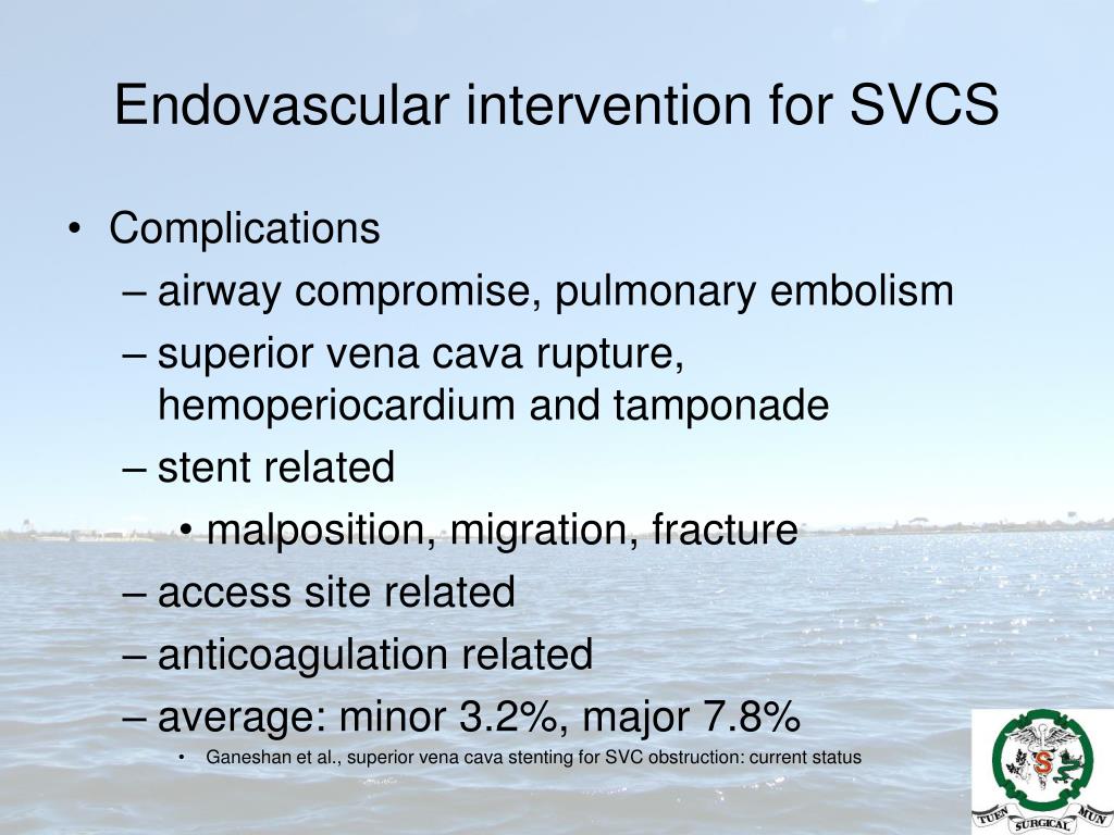 PPT - Management of Superior Vena Cava Syndrome Perspective from ...