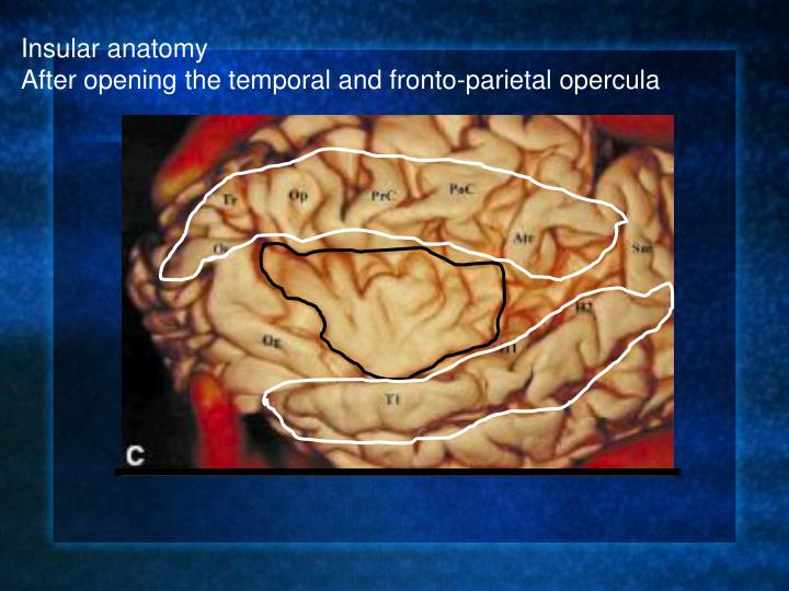 PPT - Insular anatomy After opening the temporal and fronto-parietal ...