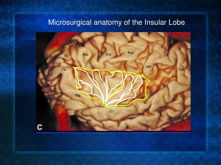 PPT - Insular anatomy After opening the temporal and fronto-parietal ...