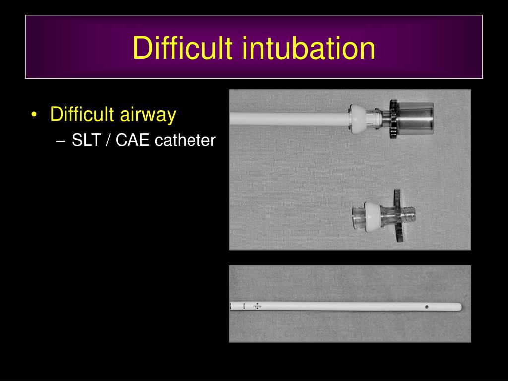 PPT - Thoracic Anaesthesia Post-Fellowship Study Day PowerPoint ...