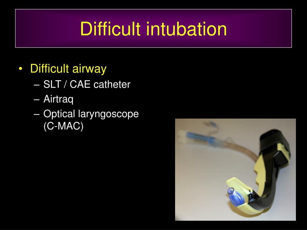 PPT - Thoracic Anaesthesia Post-Fellowship Study Day PowerPoint ...