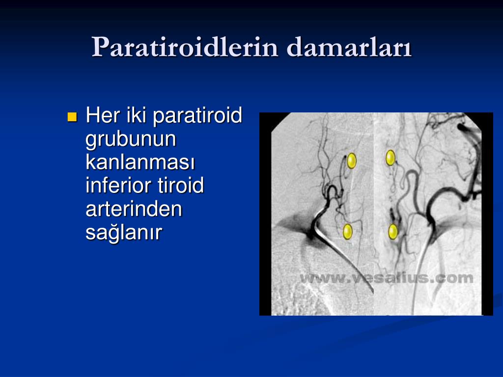 PPT - PARATİROİD HASTALIKLARI Prof. Dr. Cavit ÇÖL Genel Cerrahi ...