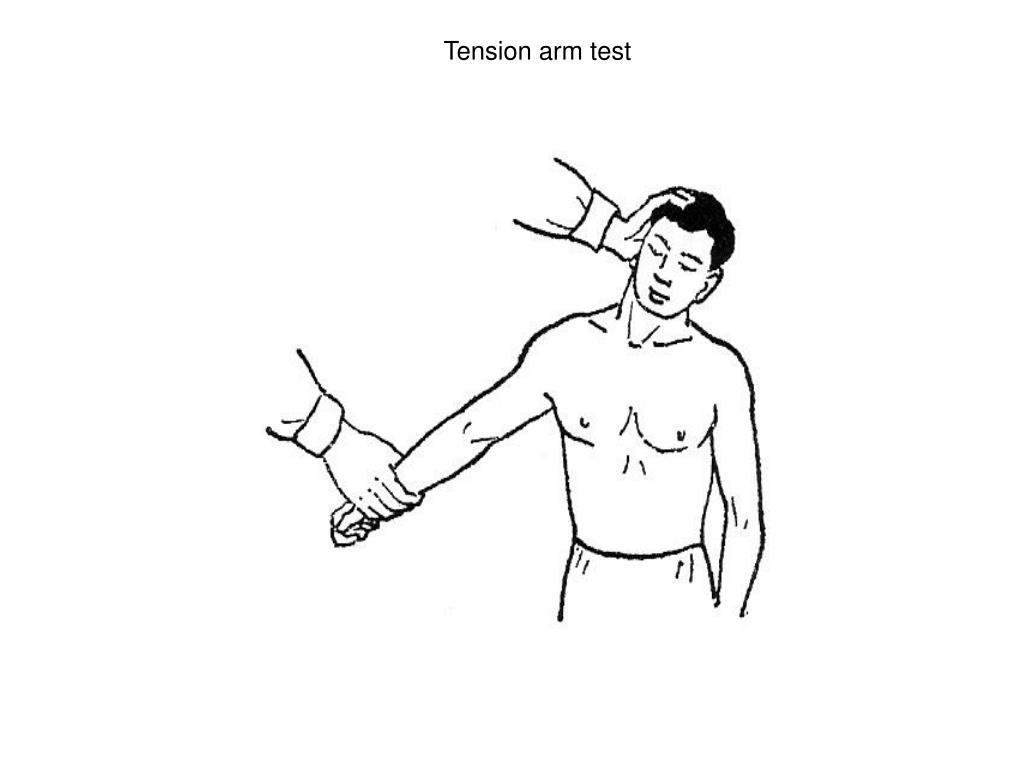 PPT - Pathogenesis and TCM Treatment of Cervical Spondylosis PowerPoint ...