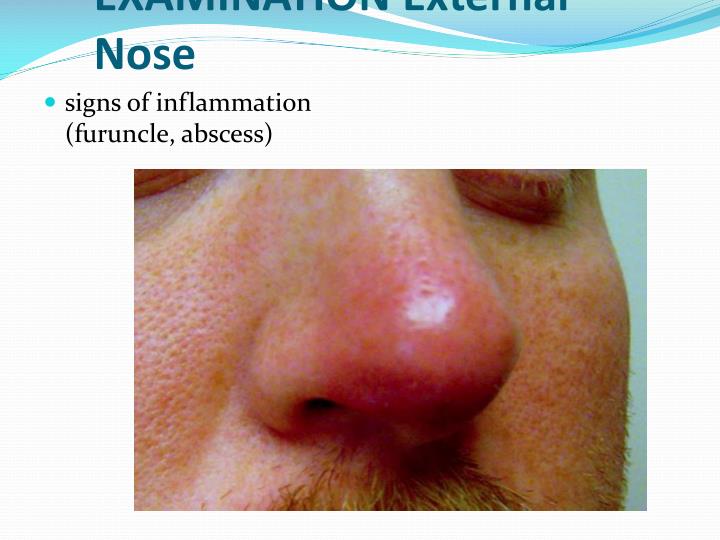 PPT - introduction to ENT History and Clinical Examination PowerPoint ...