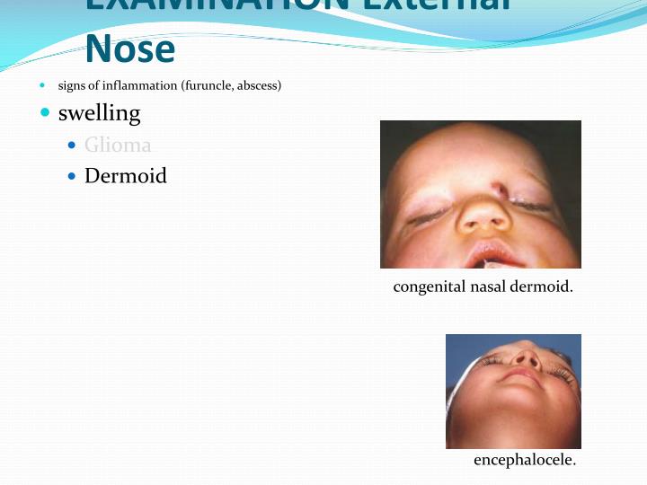 PPT - introduction to ENT History and Clinical Examination PowerPoint ...
