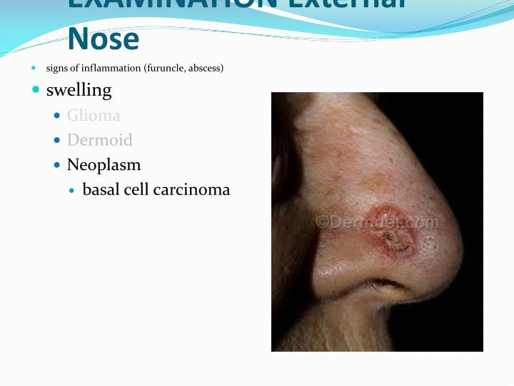 PPT - introduction to ENT History and Clinical Examination PowerPoint ...