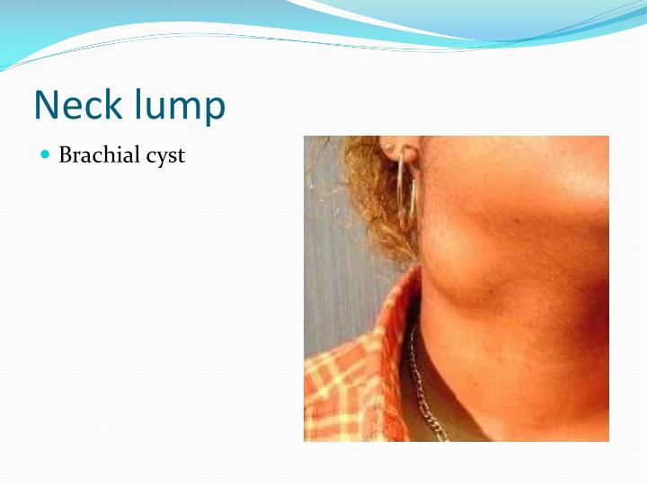 PPT - introduction to ENT History and Clinical Examination PowerPoint ...