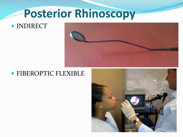 PPT - introduction to ENT History and Clinical Examination PowerPoint ...