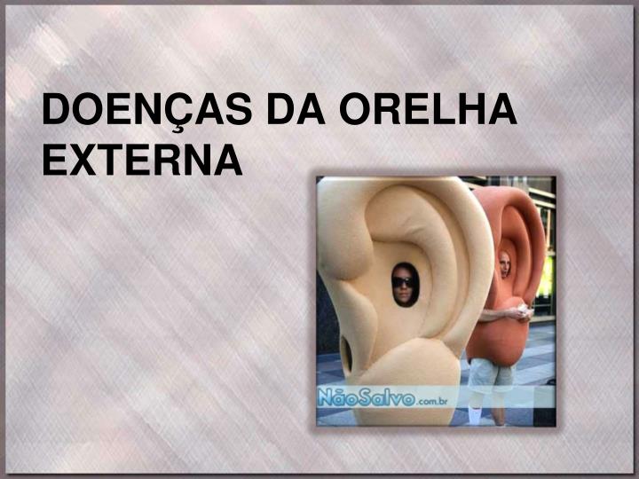 PPT - OTITEs PowerPoint Presentation - ID:3055967