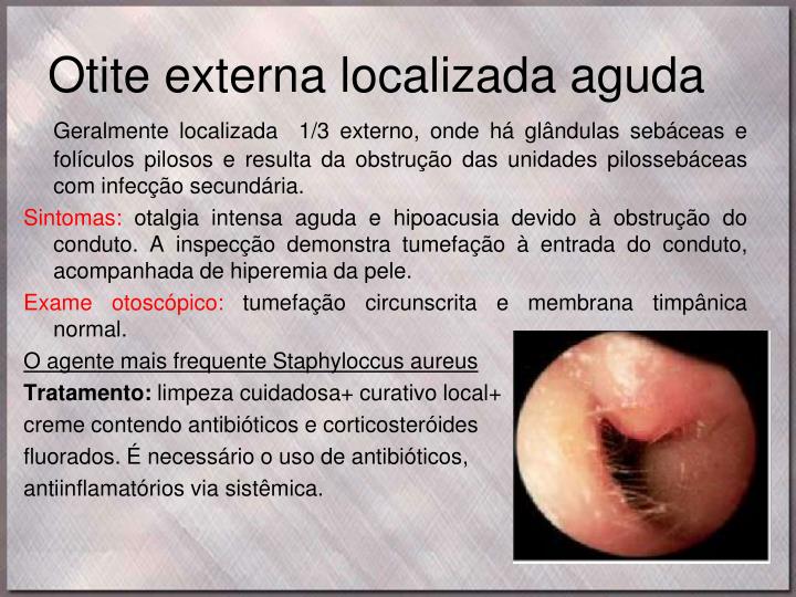 PPT - OTITEs PowerPoint Presentation - ID:3055967