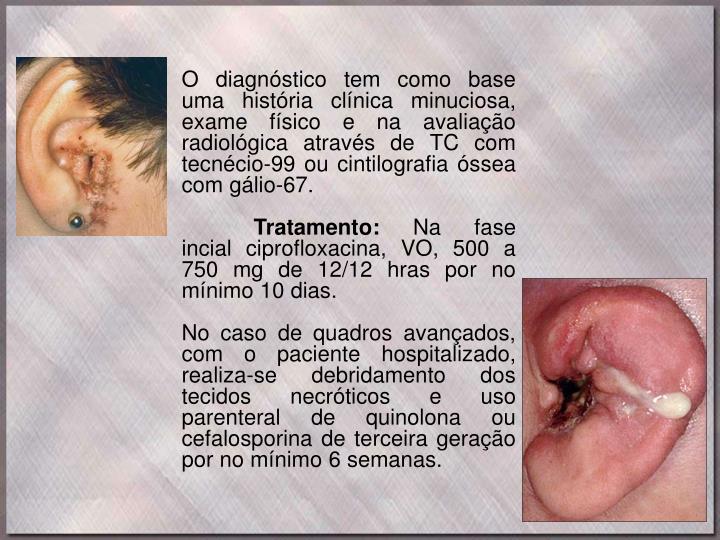 PPT - OTITEs PowerPoint Presentation - ID:3055967