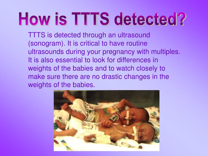 PPT - TTTS PowerPoint Presentation - ID:3058552