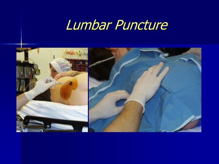 PPT - Lumbar Puncture PowerPoint Presentation - ID:3060338 PPT - Lumbar Puncture PowerPoint Presentation - ID:3060338