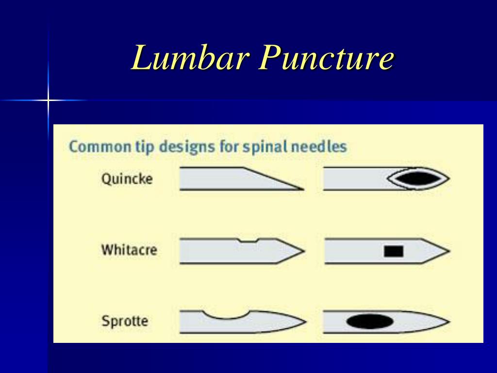 PPT - Lumbar Puncture PowerPoint Presentation, free download - ID:3060338 PPT - Lumbar Puncture PowerPoint Presentation, free download - ID:3060338