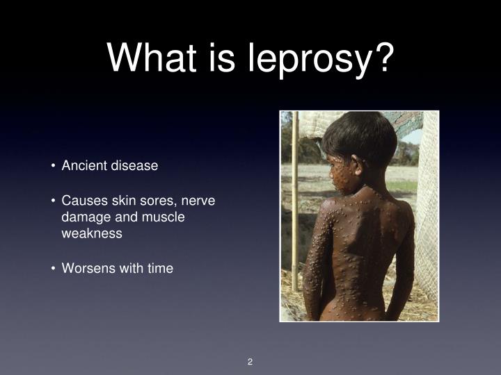 PPT - Leprosy PowerPoint Presentation - ID:3060390