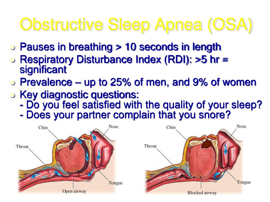 PPT - Sleep: The Golden Chain That Ties Health and Our Bodies Together ...