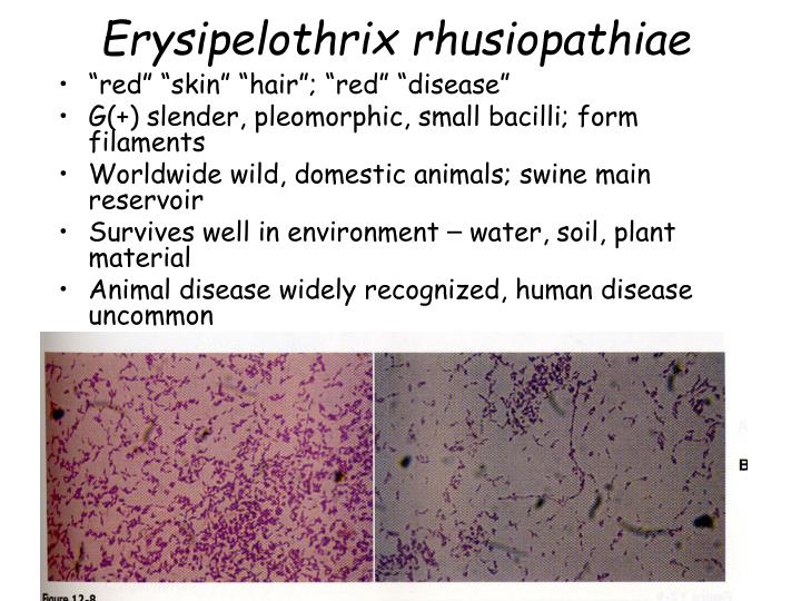 PPT - Corynebacterium , Listeria , Erysipelothrix PowerPoint ...