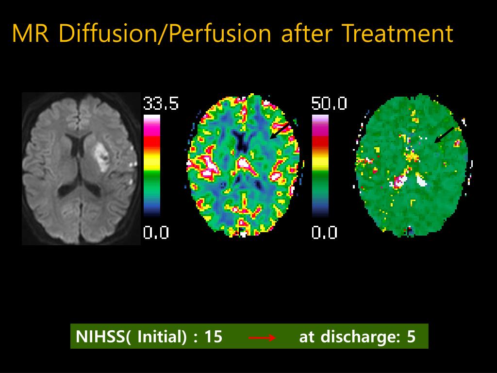 PPT - Kim, Sun-Yong, M.D. Department of Radiology Ajou University ...