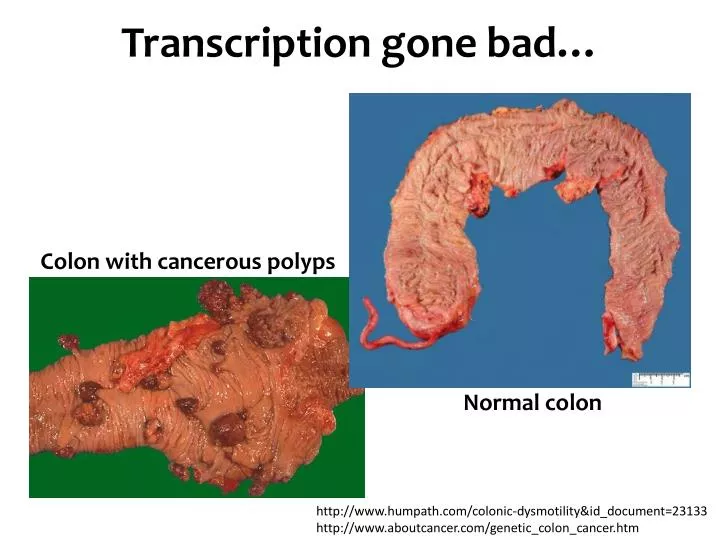 PPT - Normal colon PowerPoint Presentation, free download - ID:3064313