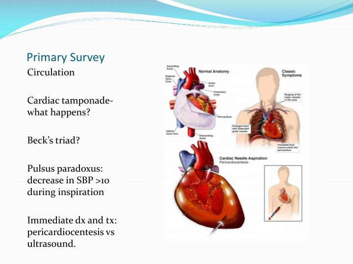 PPT - ATLS, Chapter 4: Thoracic Trauma PowerPoint Presentation - ID:3066590