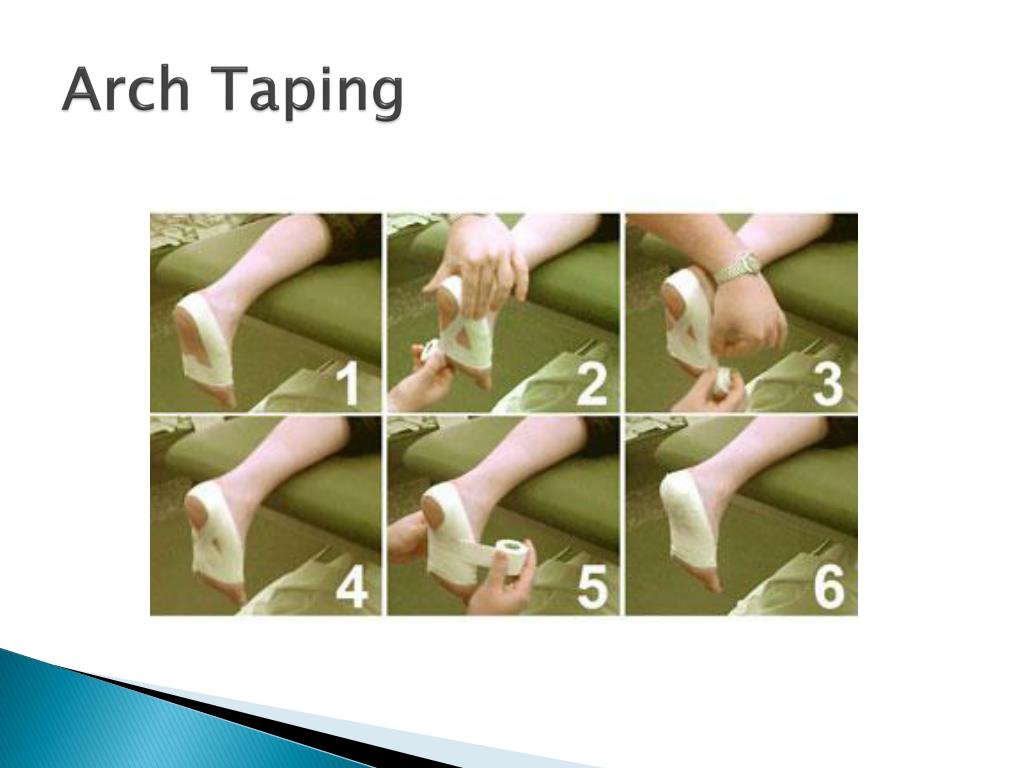 PPT - Foot, Ankle and Lower Leg PowerPoint Presentation, free download ...