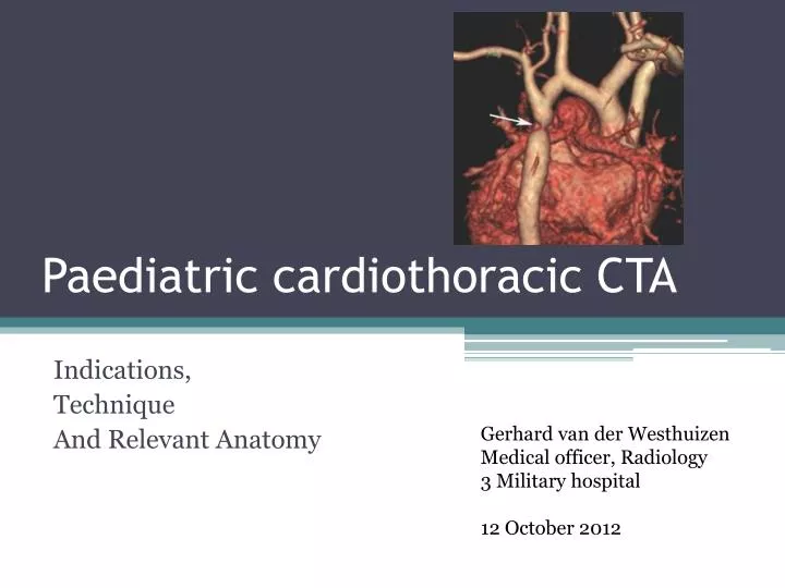 PPT - Paediatric cardiothoracic CTA PowerPoint Presentation, free ...