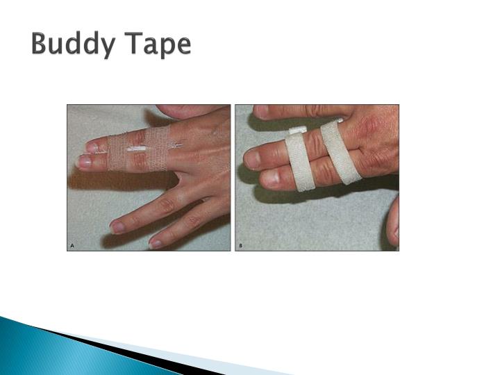 PPT - Elbow, Wrist and Hand PowerPoint Presentation - ID:3067699