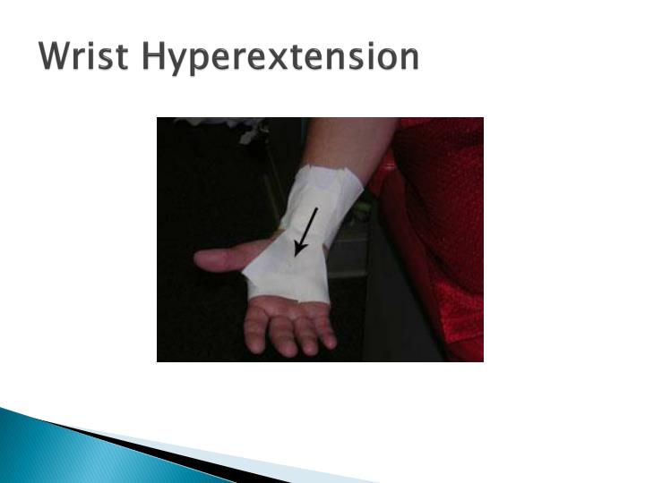 PPT - Elbow, Wrist and Hand PowerPoint Presentation - ID:3067699