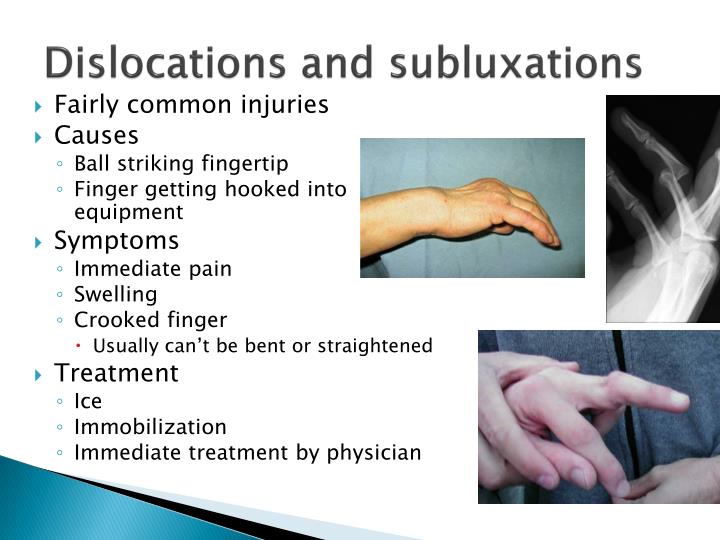 PPT - The Elbow, Wrist, and Hand PowerPoint Presentation - ID:3067717