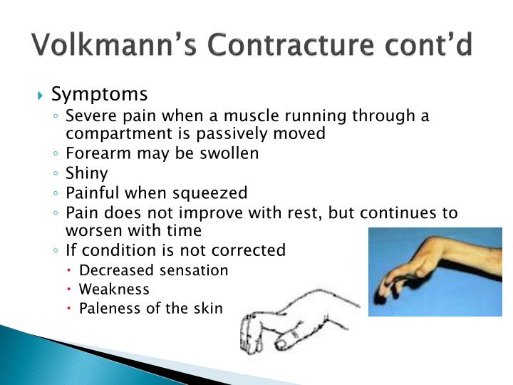 PPT - The Elbow, Wrist, and Hand PowerPoint Presentation - ID:3067717
