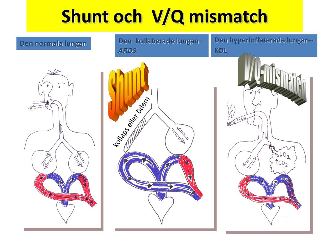 PPT - Gamla och nya ventilationssätt, hur är de olika och vilka ska vi ...