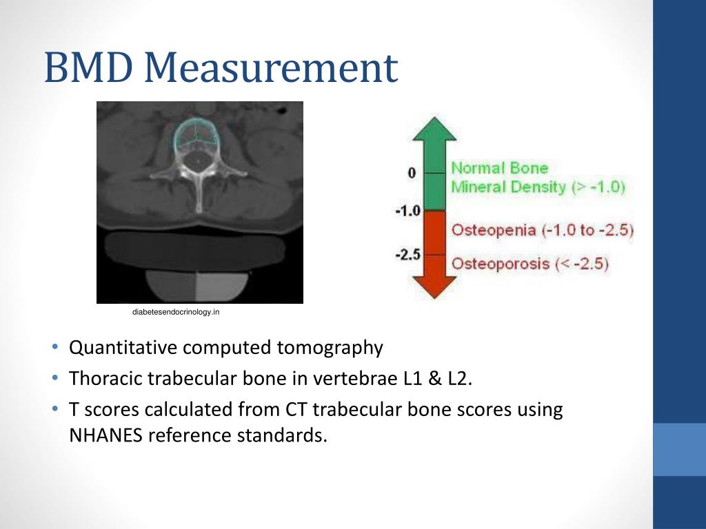 PPT - Alexandra Lajoie MD, PGY3 University of Washington Department of ...