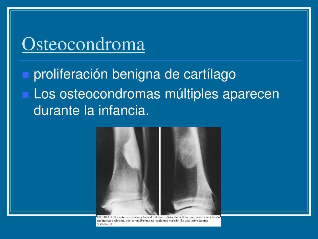 PPT - Huesos, Articulaciones y Tumores de las Partes Blandas PowerPoint ...