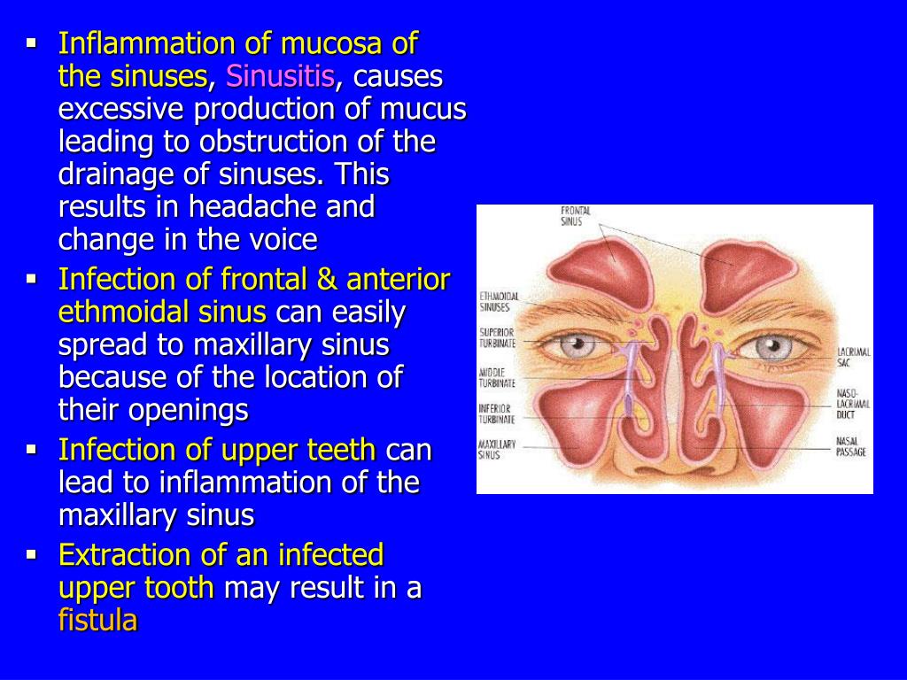 PPT - Nose, Nasal cavity & Paranasal Sinuses PowerPoint Presentation ...