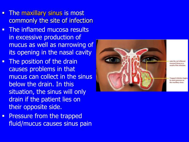 PPT - Nose, Nasal cavity & Paranasal Sinuses PowerPoint Presentation ...
