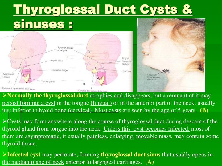 PPT - The Respiratory System PowerPoint Presentation - ID:3071951